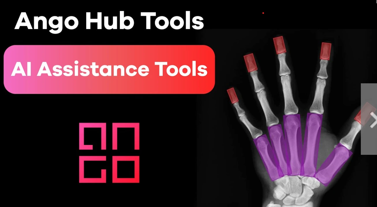 Top Medical Image Annotation Services for 2025[Updated]